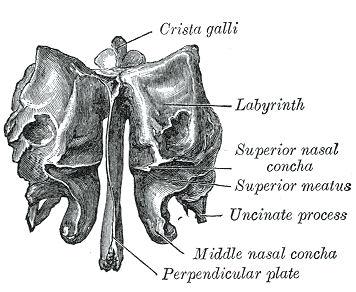 Ethmoid Bone - Radiologica