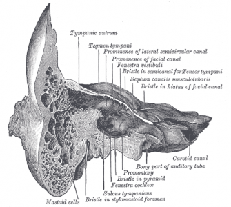 Temporal Bone - Radiologica